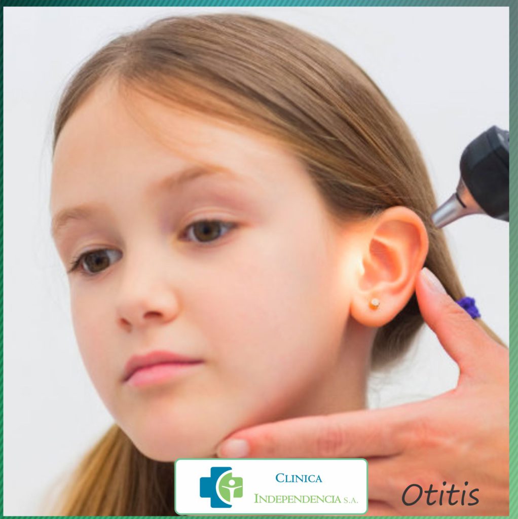 Otitis Qué Es Cuáles Son Sus Síntomas Cómo Se Trata Y Previene El Regional Digital